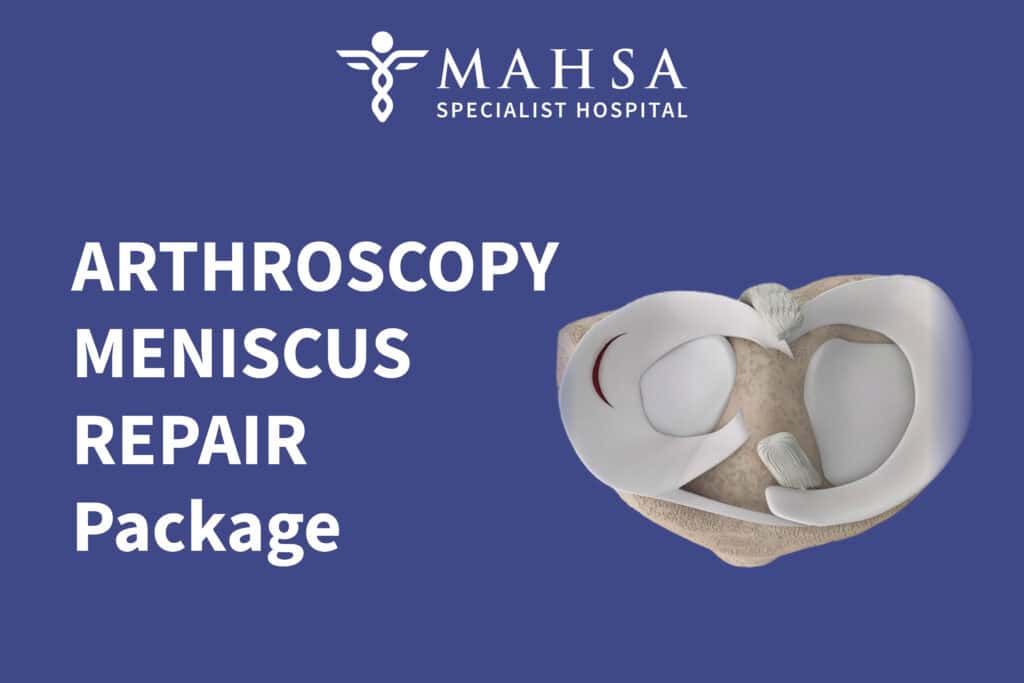 Arthroscopy Meniscus Repair Package - MAHSA Specialist Hospital
